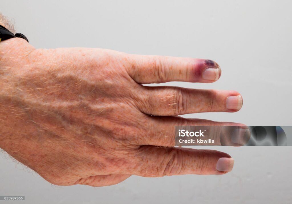 Blood Poisoning - Englisch.net